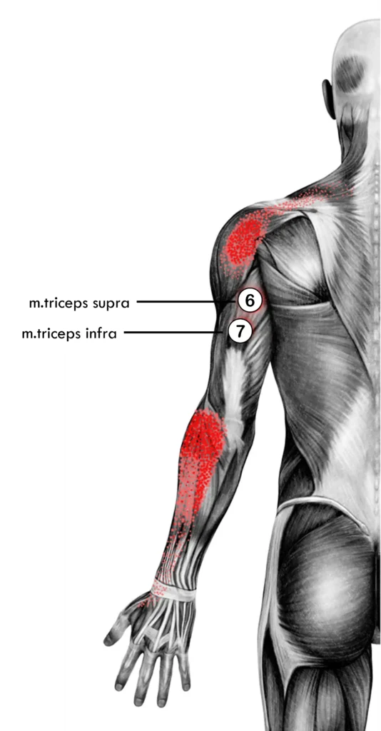 Arms Trigger Points - The|Tides BrainBodyMind Wellness