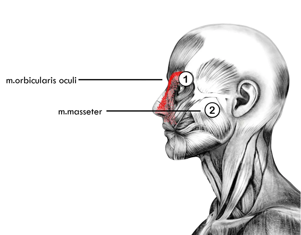 Face and Scalp Trigger Points - The|Tides BrainBodyMind Wellness