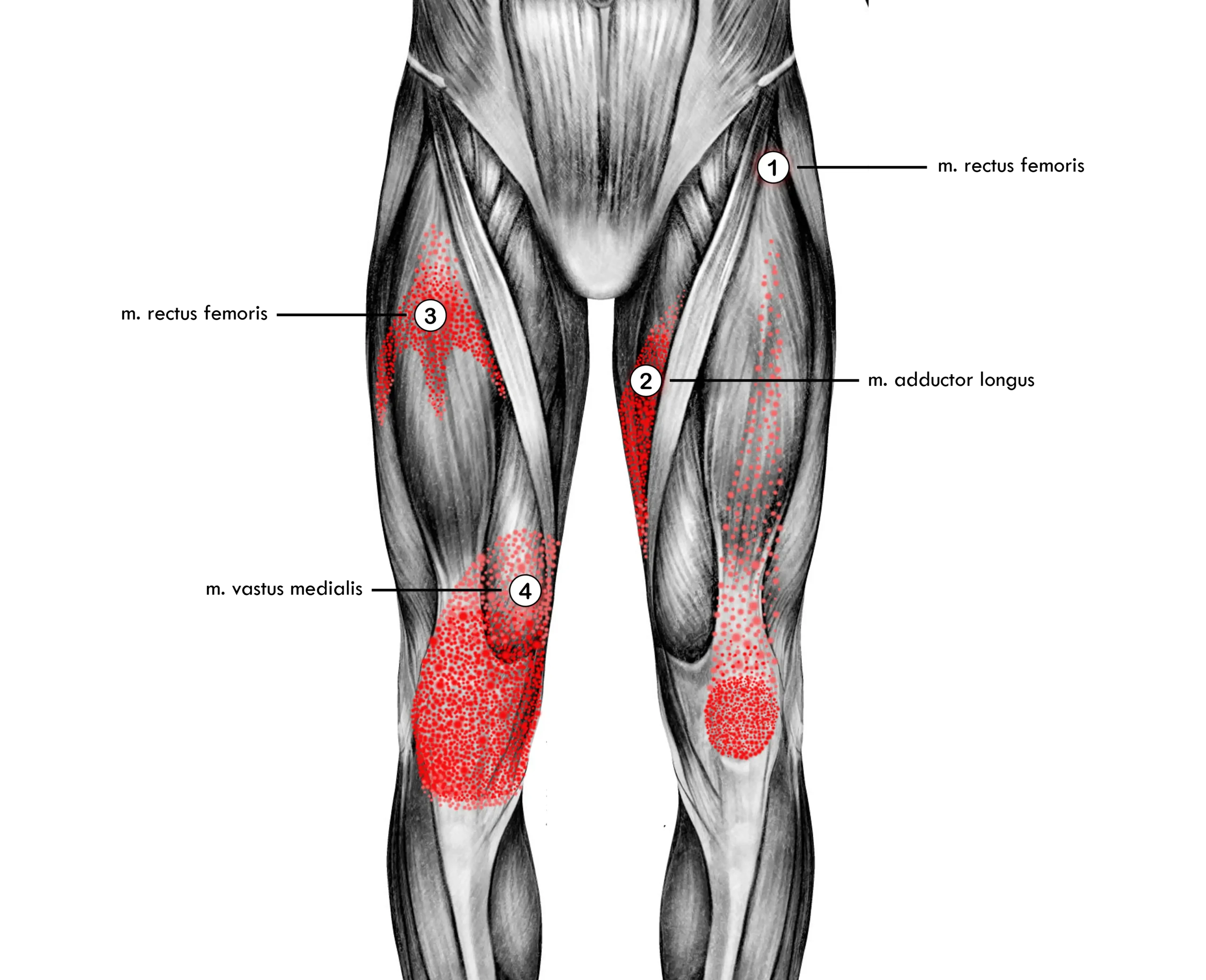 Front Legs Trigger Points - The|Tides Wellness